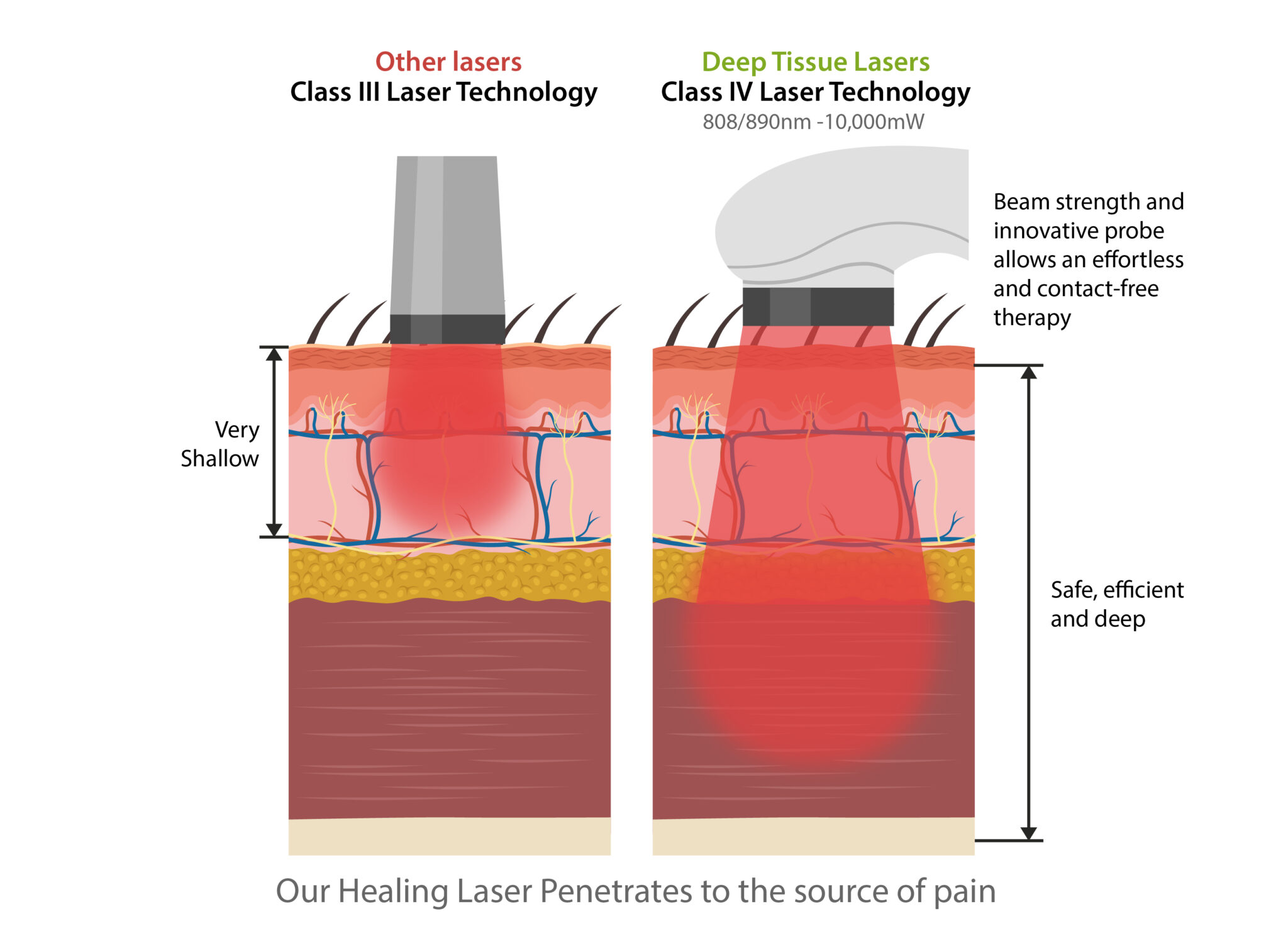 Class IV Laser Therapy – Crossroads Brain & Spine