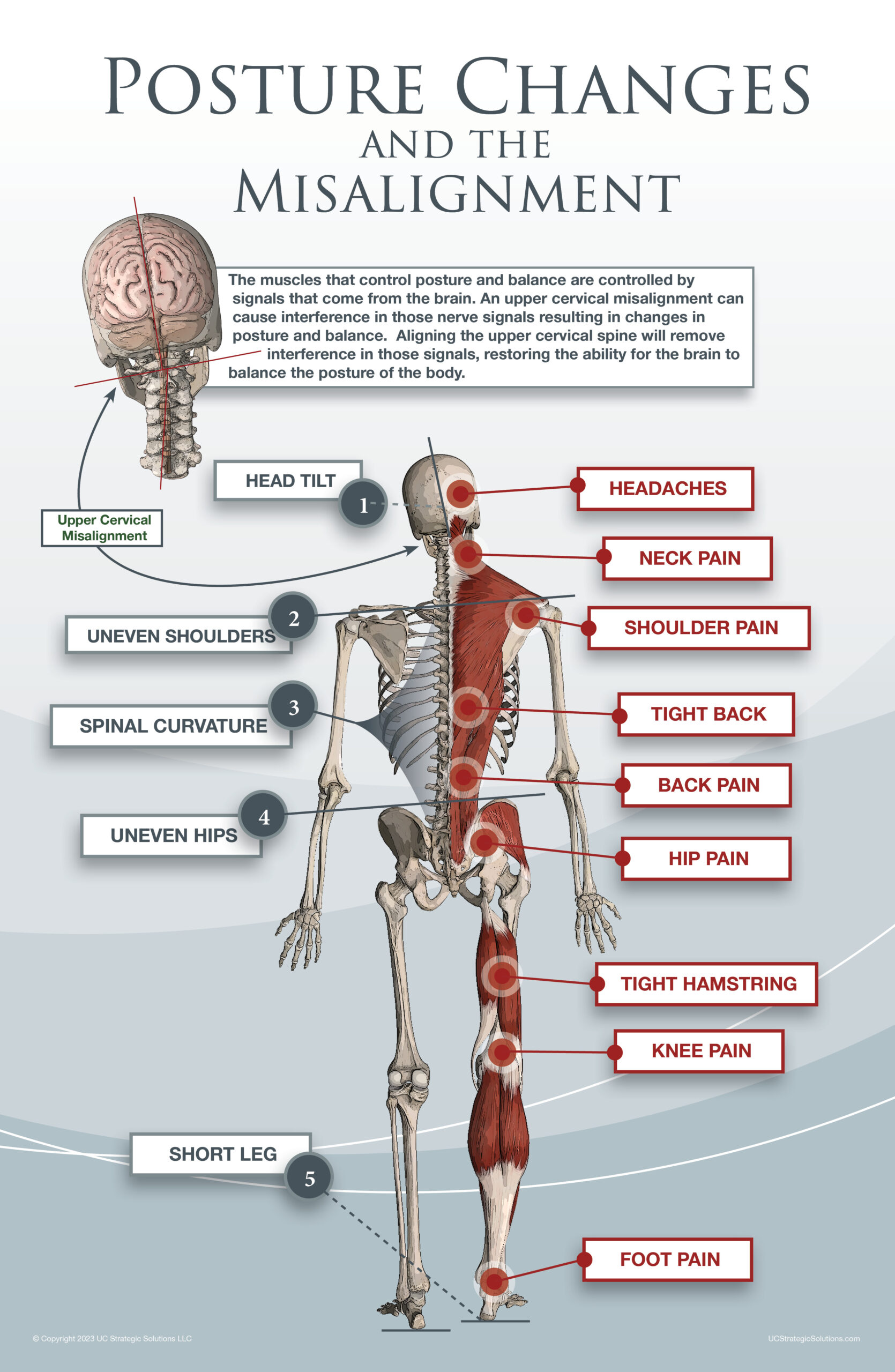 Upper Cervical Spinal Care – Crossroads Brain & Spine